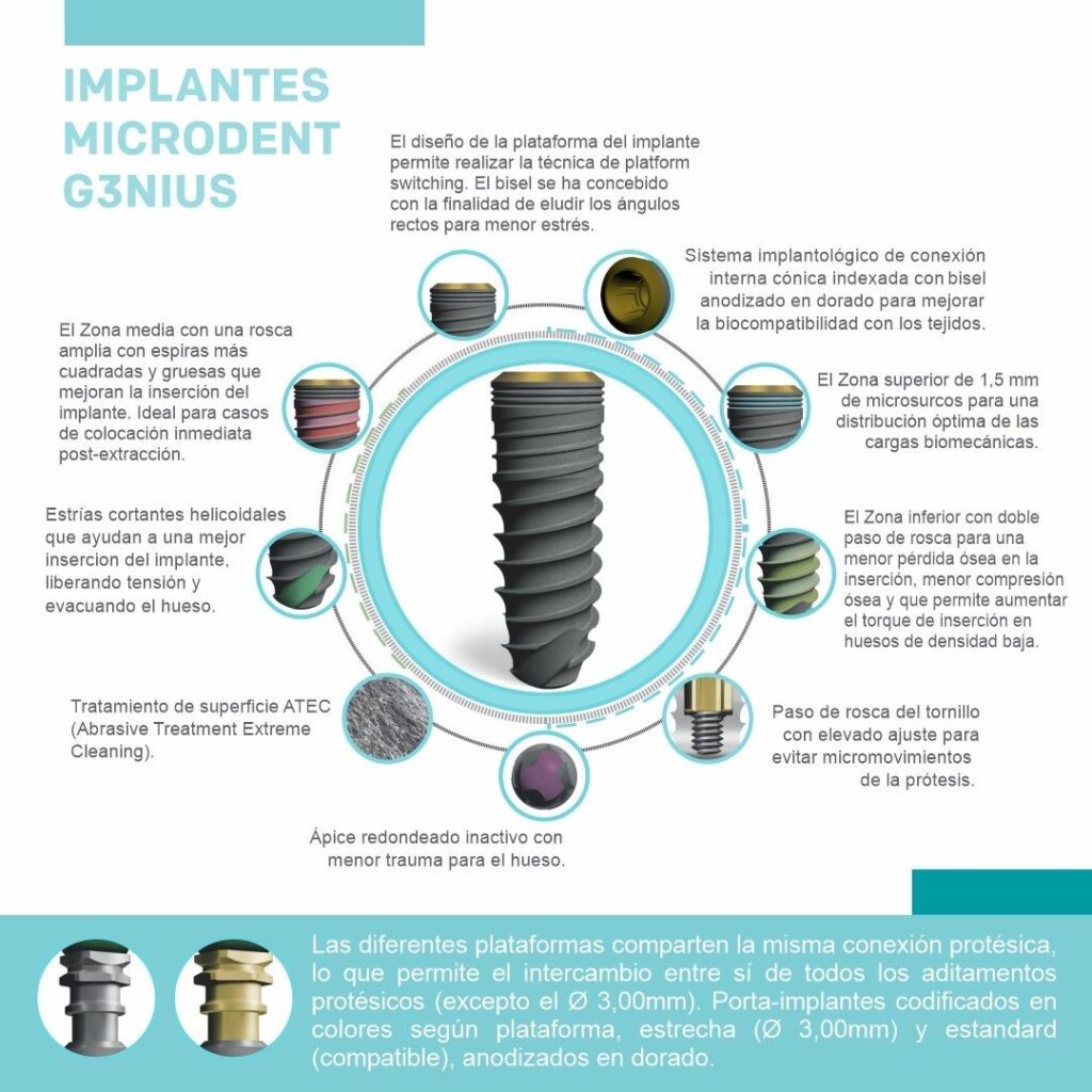 Microdent Implant System - Embrioss