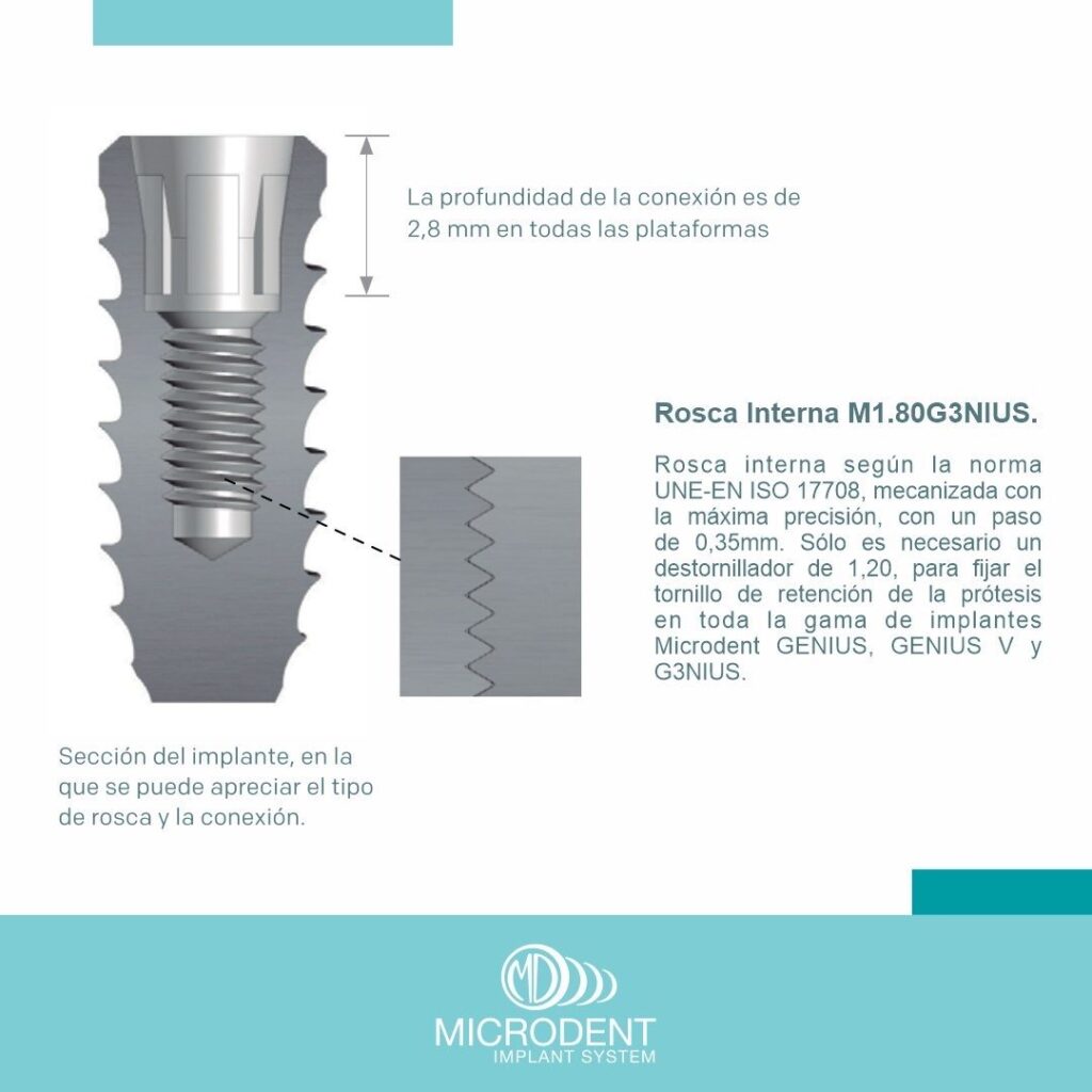 Microdent Implant System - Embrioss